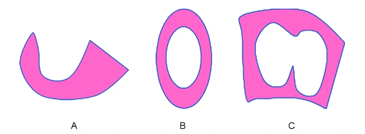 Clasp Designs | Non-Metal Clasp Dentures | Continuing Education Course ...