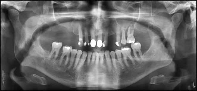 Image Evaluation - Practical Panoramic Imaging - Dentalcare