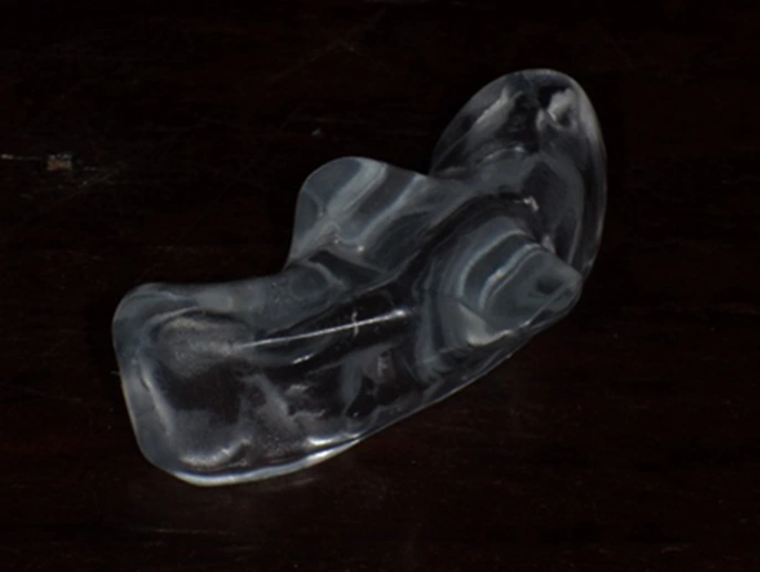 Treatment Modalities - Bruxism: The Grind of the Matter - Dentalcare