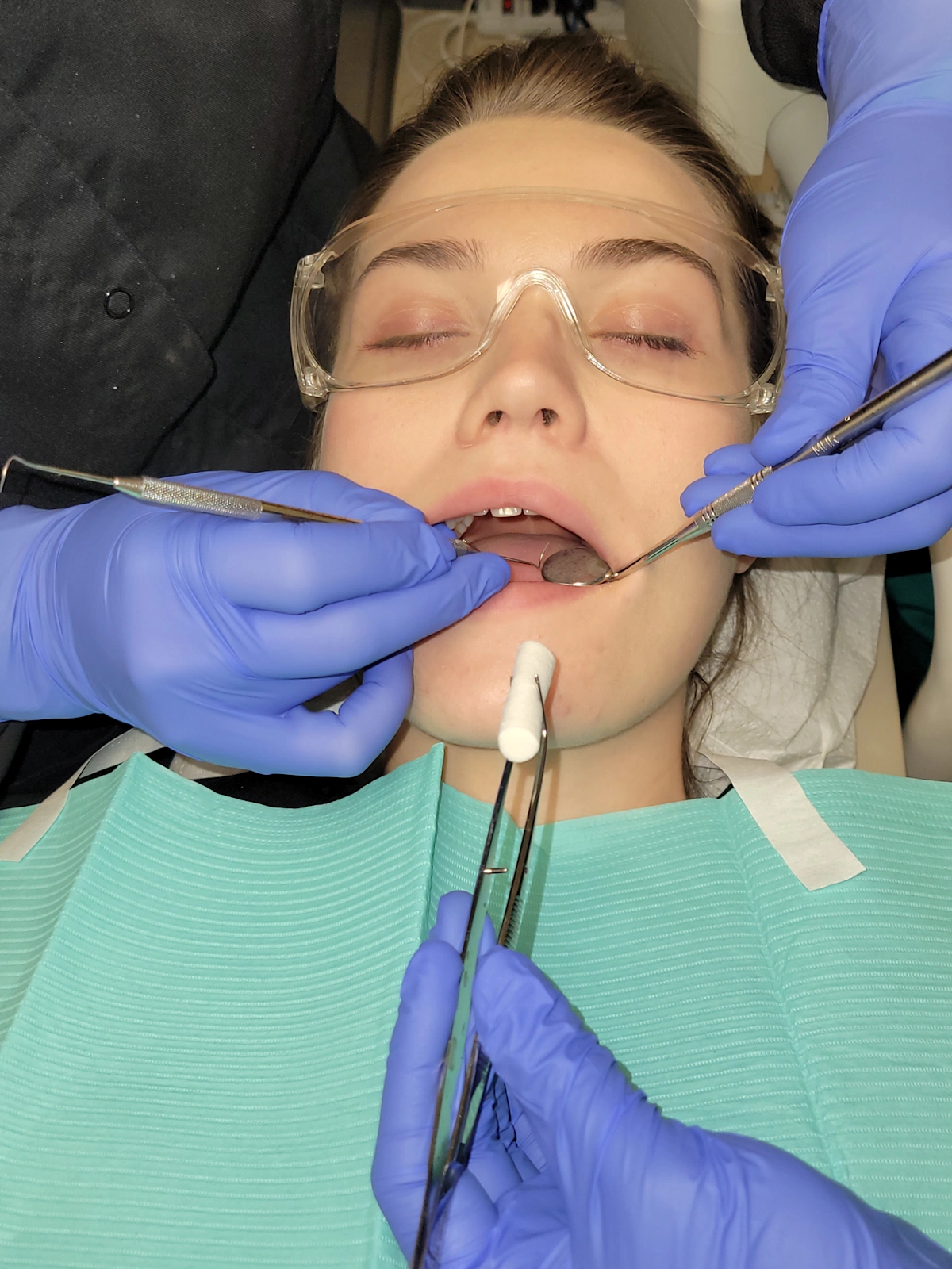 Use of Non-Locking Forceps - The Concepts of Four-handed Dentistry ...