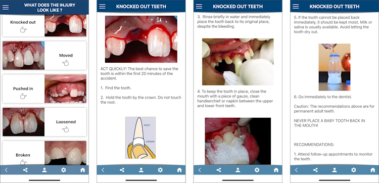 ToothSOS app | Sports dentistry - Education and Prevention: Play it ...