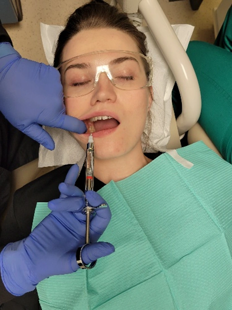 Syringe Transfer - The Concepts of Four-handed Dentistry Including ...