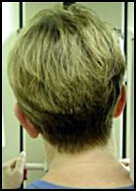 Incorrect Head Orientation - Practical Panoramic Imaging - Dentalcare