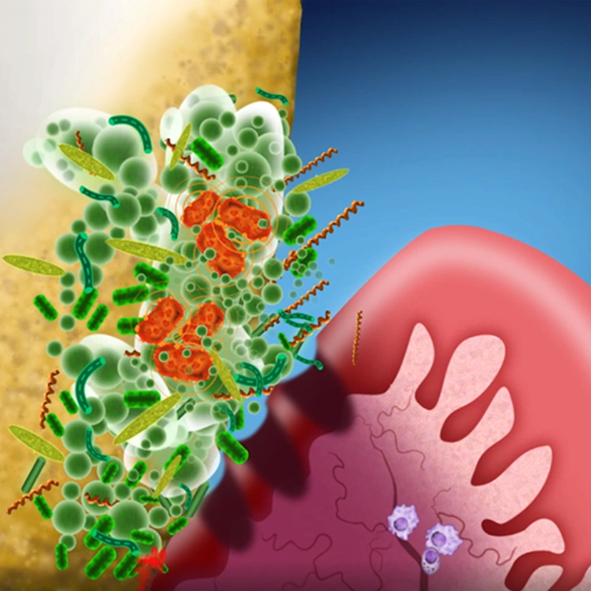 The Oral Microbiome: A New View of Plaque Biofilm - Dentalcare Course ...