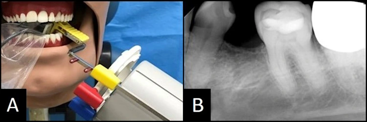 Vertical Angulation: How do I know if I can follow the aiming ring ...