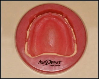 Milling | Digital Dentures | Continuing Education Course on dentalcare.com