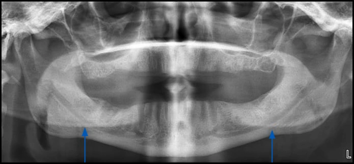 Stepwise Approach to Panoramic Technique Assessment - Practical ...