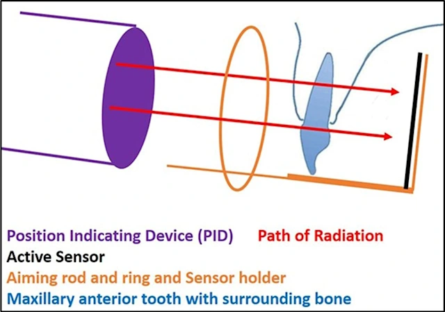The Path of Radiation | Intraoral Imaging Techniques: Beyond the ...