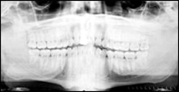 Machine Preparation Errors - Practical Panoramic Imaging - Dentalcare