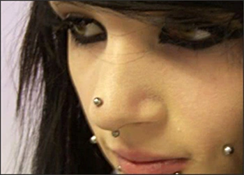 Definition of Oral Piercing - Oral Piercings: Implications for Dental ...