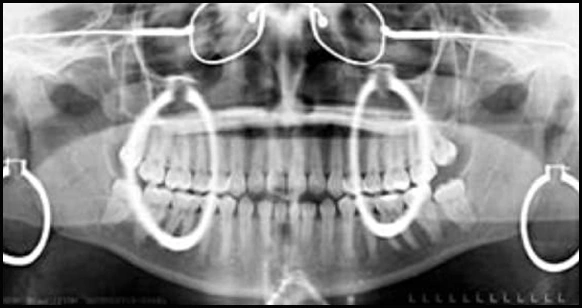 Stepwise Approach to Panoramic Technique Assessment - Practical ...