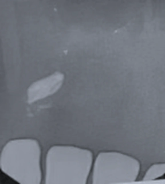 Desensitization Techniques - Radiographic Techniques for the Pediatric ...