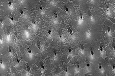 Stannous Fluoride & Sensitivity - CE Course | dentalcare.com