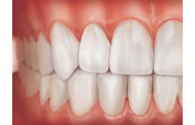 Dental Patient Education - Patient Education Topic - Gingival Health ...