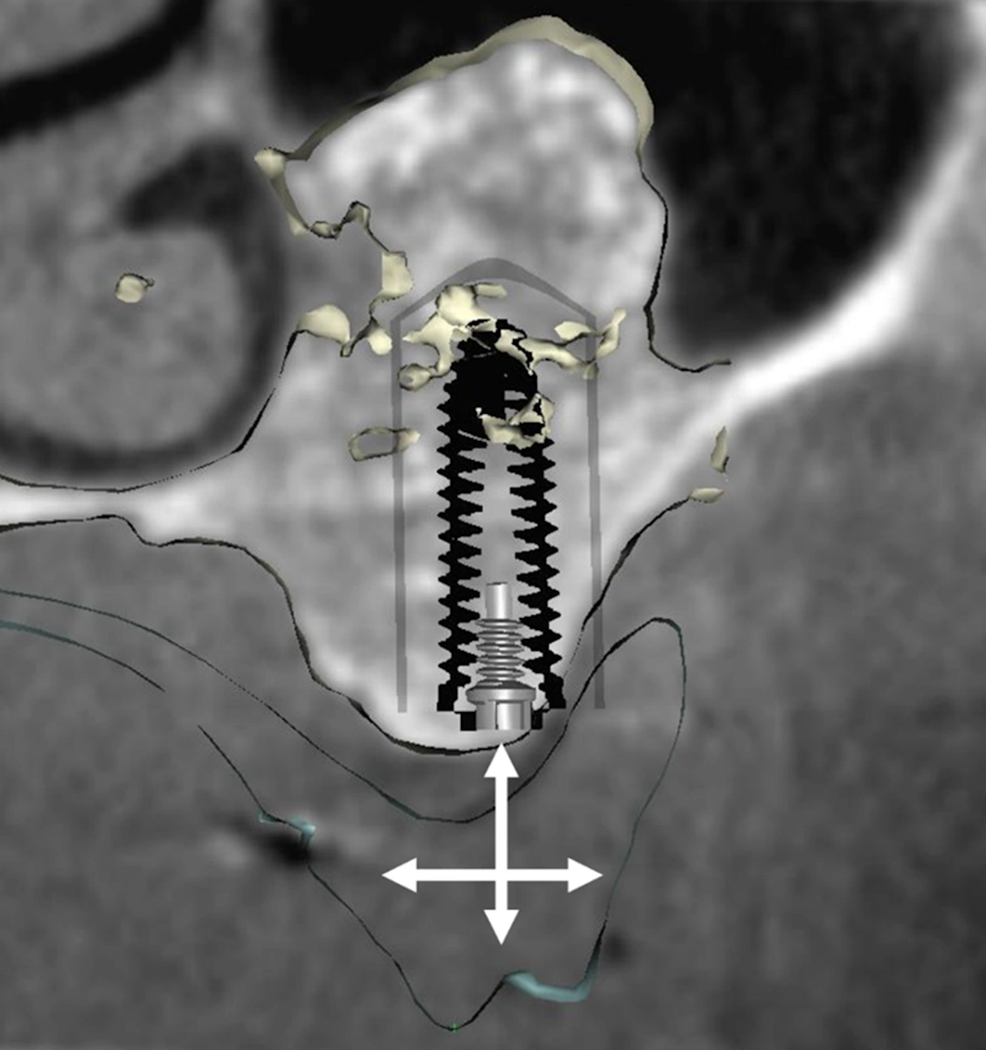 Assessment of the Restorative Space | Biologically Contoured Esthetic ...