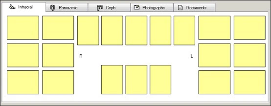 Digital Systems - Intraoral Radiographic Anatomy - Dentalcare
