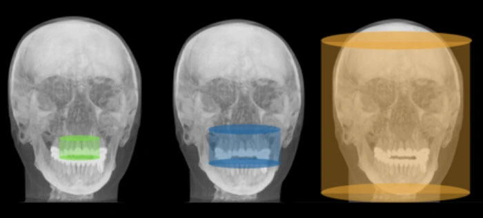 Principles of CBCT - Cone-Beam Computed Tomography (CBCT) Applications ...