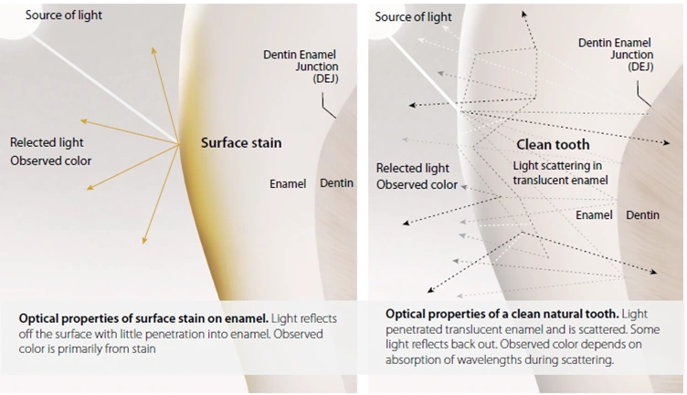Factors Influencing the Appearance of Teeth | How Whitening Works ...