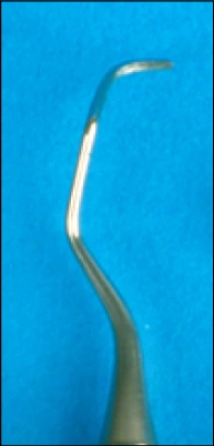 Langer Curettes - Advanced Instrumentation for the General Practice ...