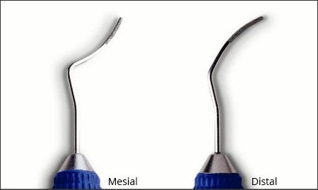 Diamond Coated File Scalers - Advanced Instrumentation for the General ...