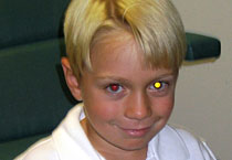 Removing the red eye effect in photos | All About Vision