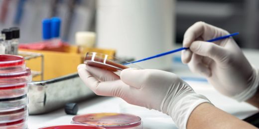 Blood Culture Contamination Reduction | SafetyCulture