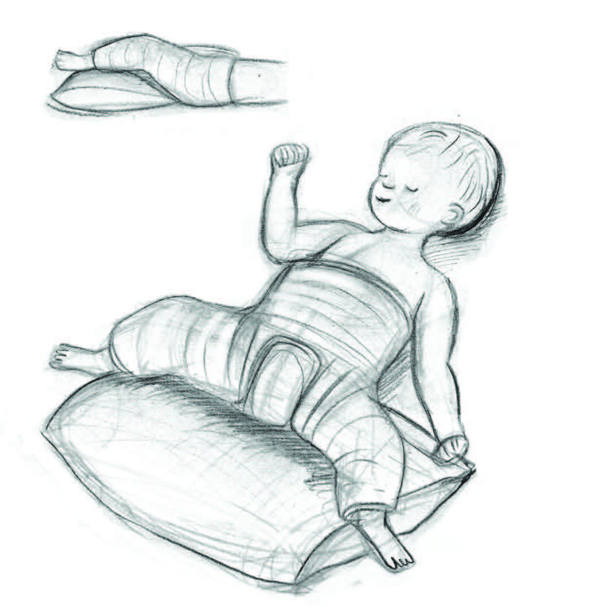 Hip spica care for an infant, child and young person