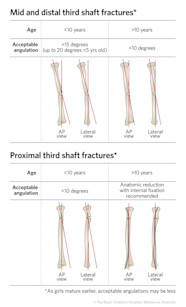 Fracture Radius And Ulna Shaft diaphyseal Fractures