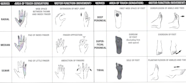 Infographic How To Study Neurovascular Assessment 6 Ps In 2021 Infographic How To Study Neurovascular Assessment 6 Ps In 2021