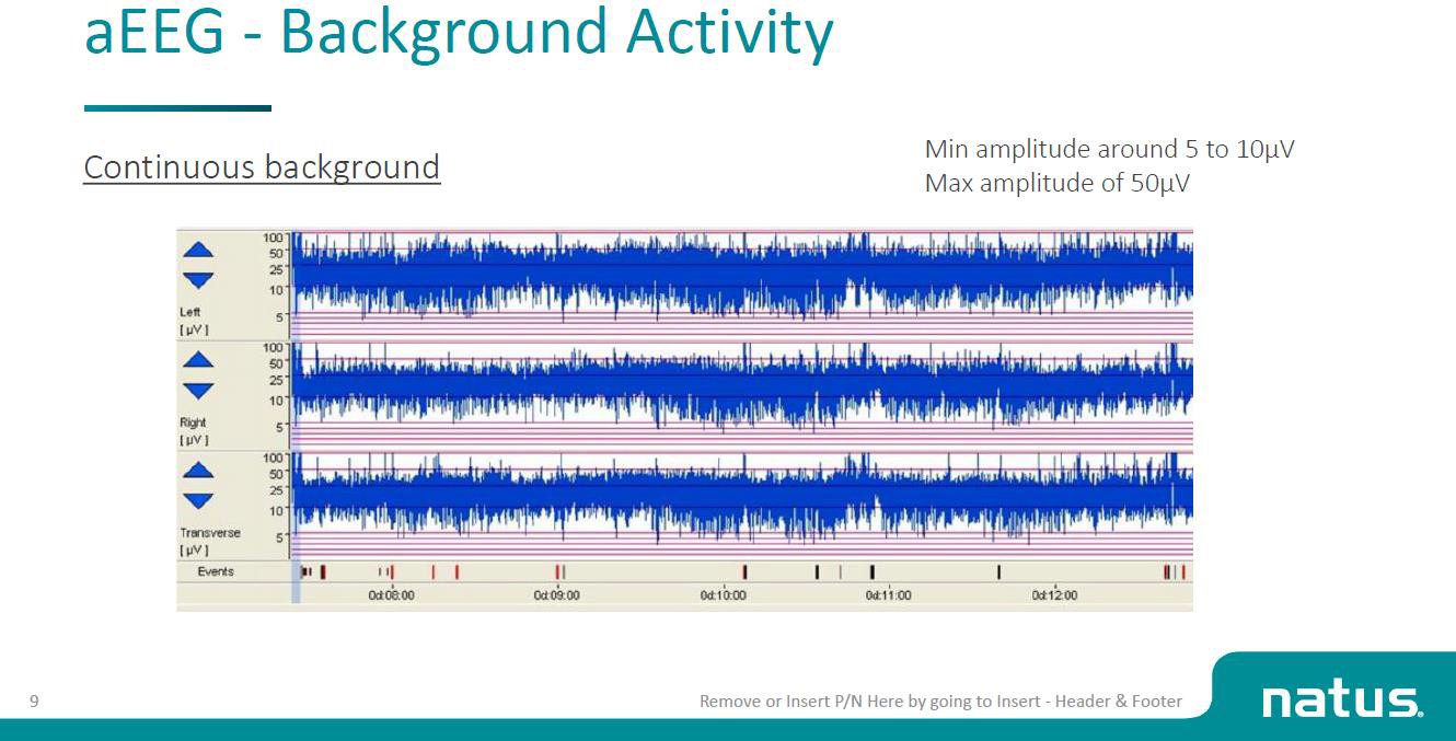 background activity 1