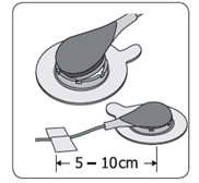 Transcutaneous CO2 monitoring