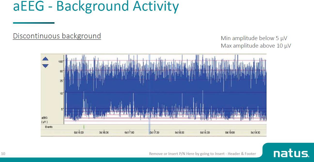 background activity 2