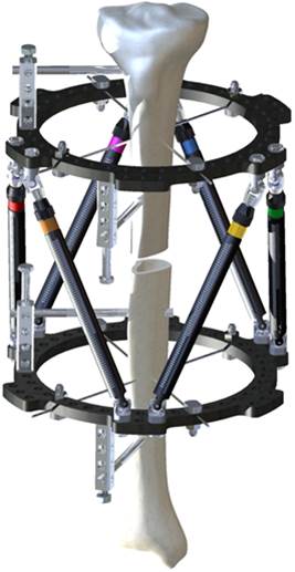 External fixator device care for an infant, child and young person