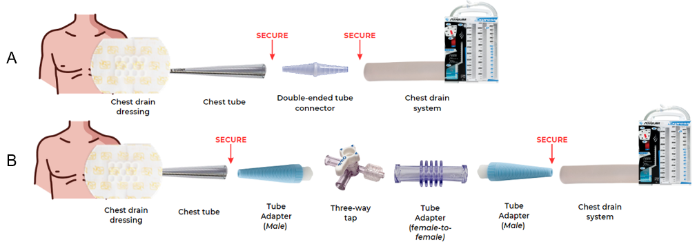 bore chest tube configurations