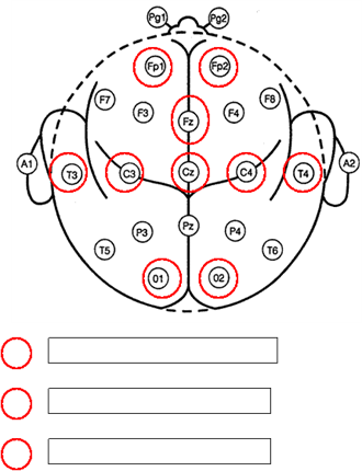 Brain monitoring in the neonate - Video aEEG