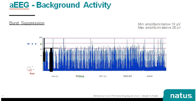Background activity 3
