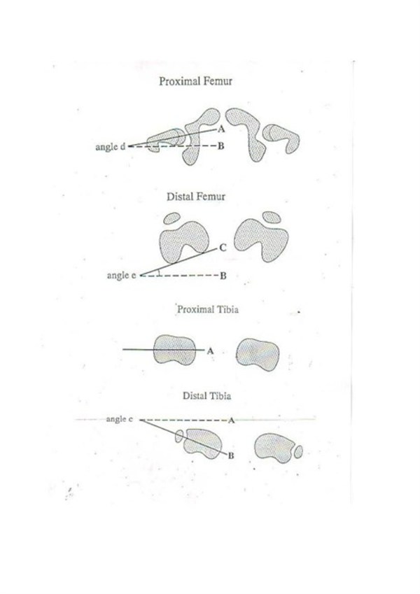 CT - Rotational Profile