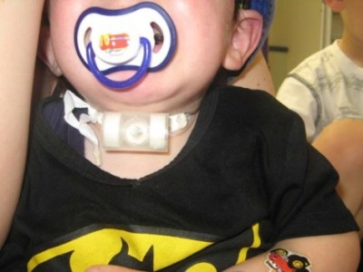 Tracheostomy management for an infant, child or young person