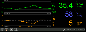 Transcutaneous CO2 monitoring