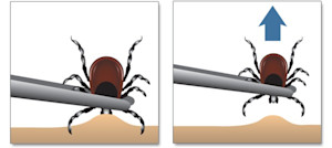 What to do if you're bitten by a tick - Everlywell Blog | At-Home ...