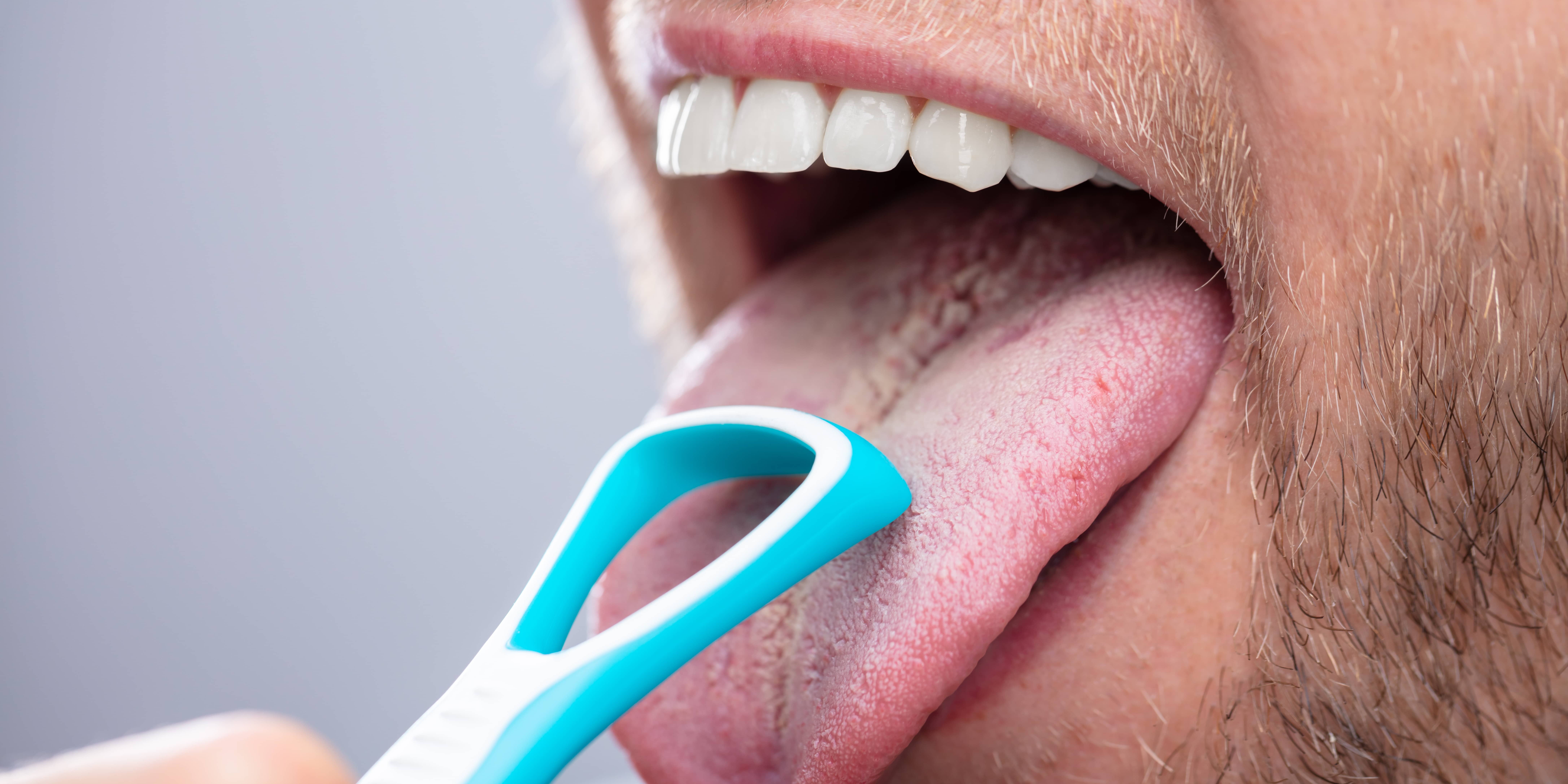 Notice something different about your tongue? It might be glossitis ...