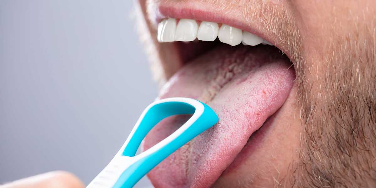 Notice something different about your tongue? It might be glossitis ...