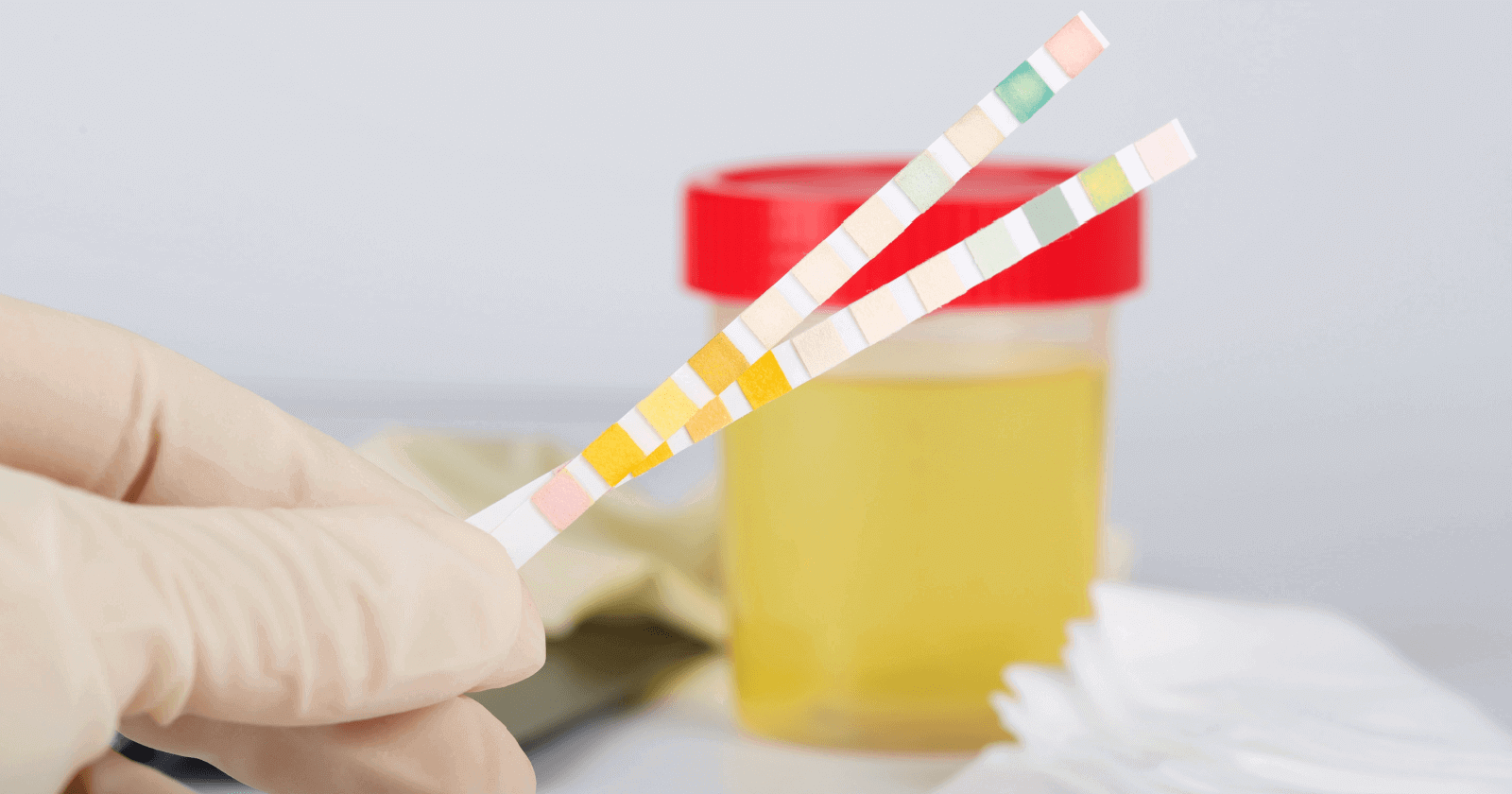 Urine Odour Meaning Symptoms Causes Treatment urine-odour-meaning-symptoms-causes-treatment