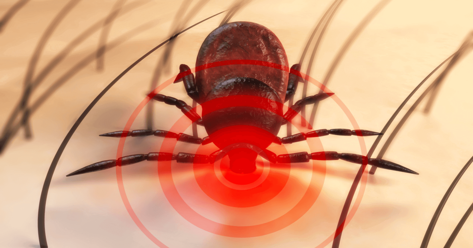 First Aid For Tick Bites Key Tips For Treating And Preventing