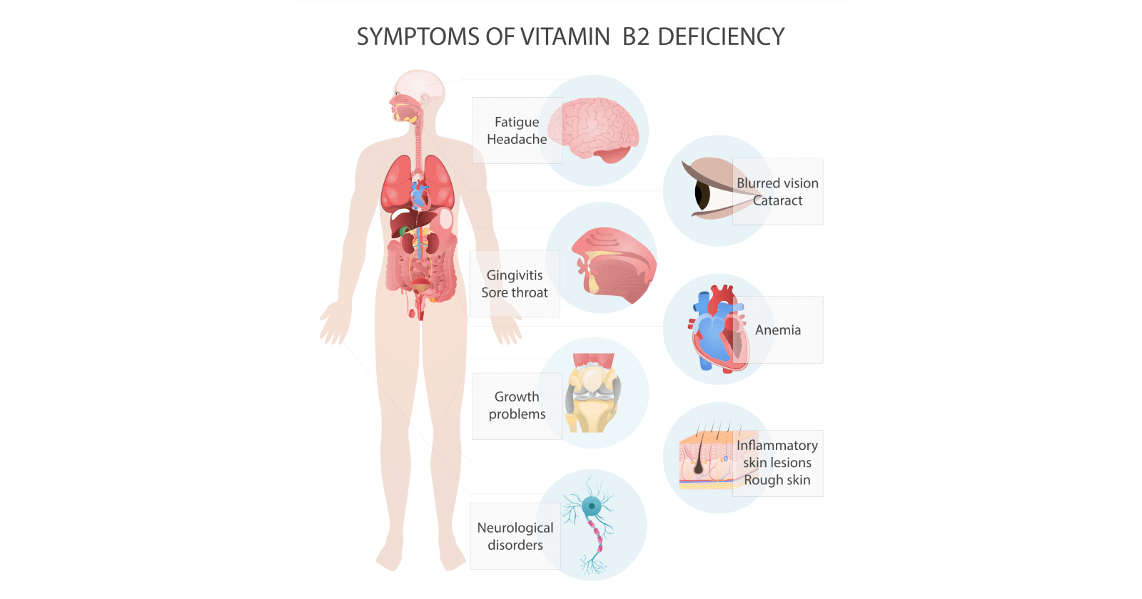 Vitamin B2 Deficiency: Symptoms, Causes, Treatment & Prevention