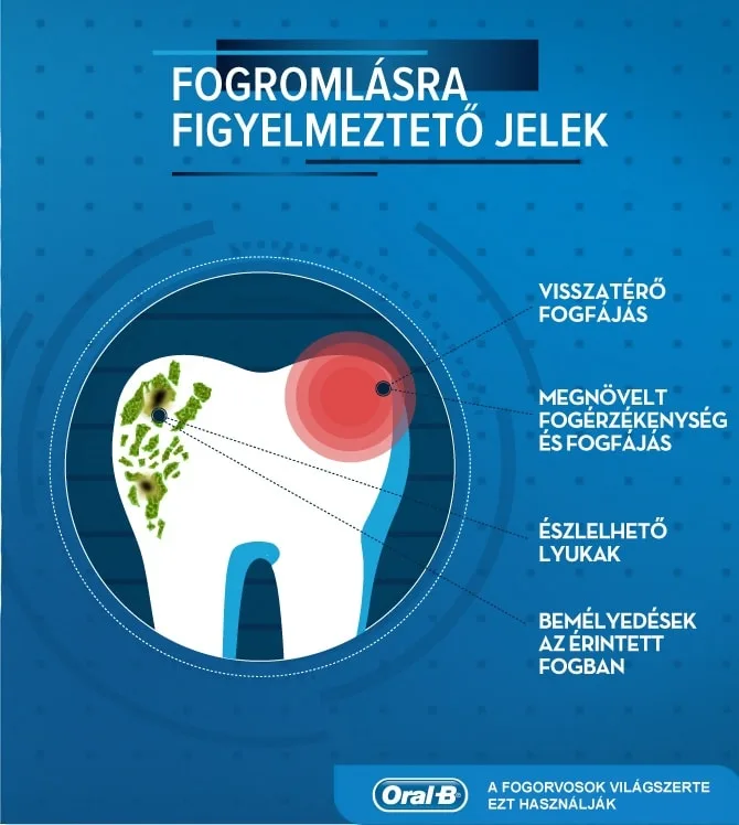 A fogszuvasodás tünetei, okai és kezelése| Oral-B