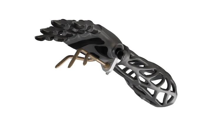 Prosthetics start-up supports amputees in India with helping hands