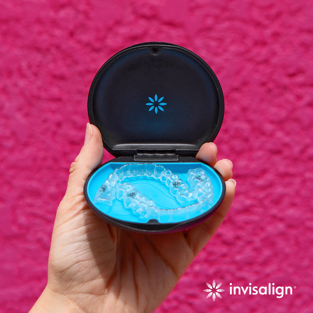 Fonctionnement du système Invisalign | Appareils fixe Invisalign