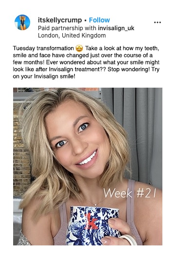 Invisalign treatment | Invisalign clear aligners