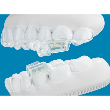 Presentamos el sistema Invisalign® con Avance Mandibular y bloques ...
